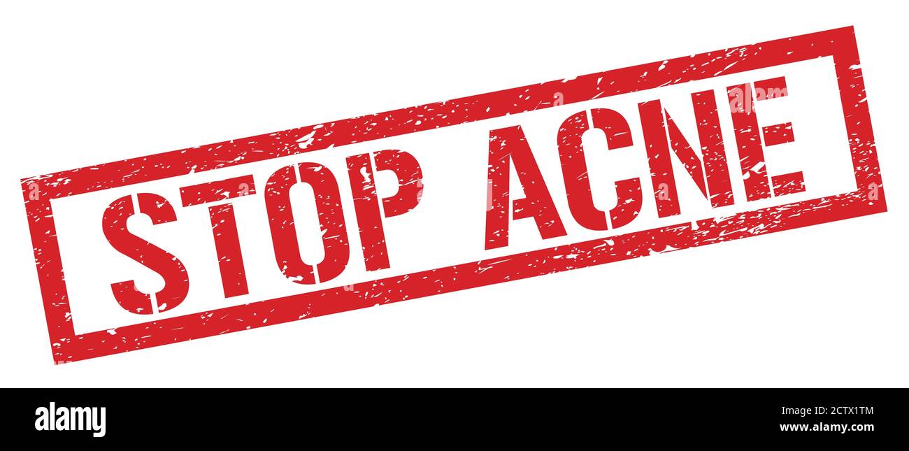 STOP ACNE red grungy rectangle stamp sign Stock Photo - Alamy