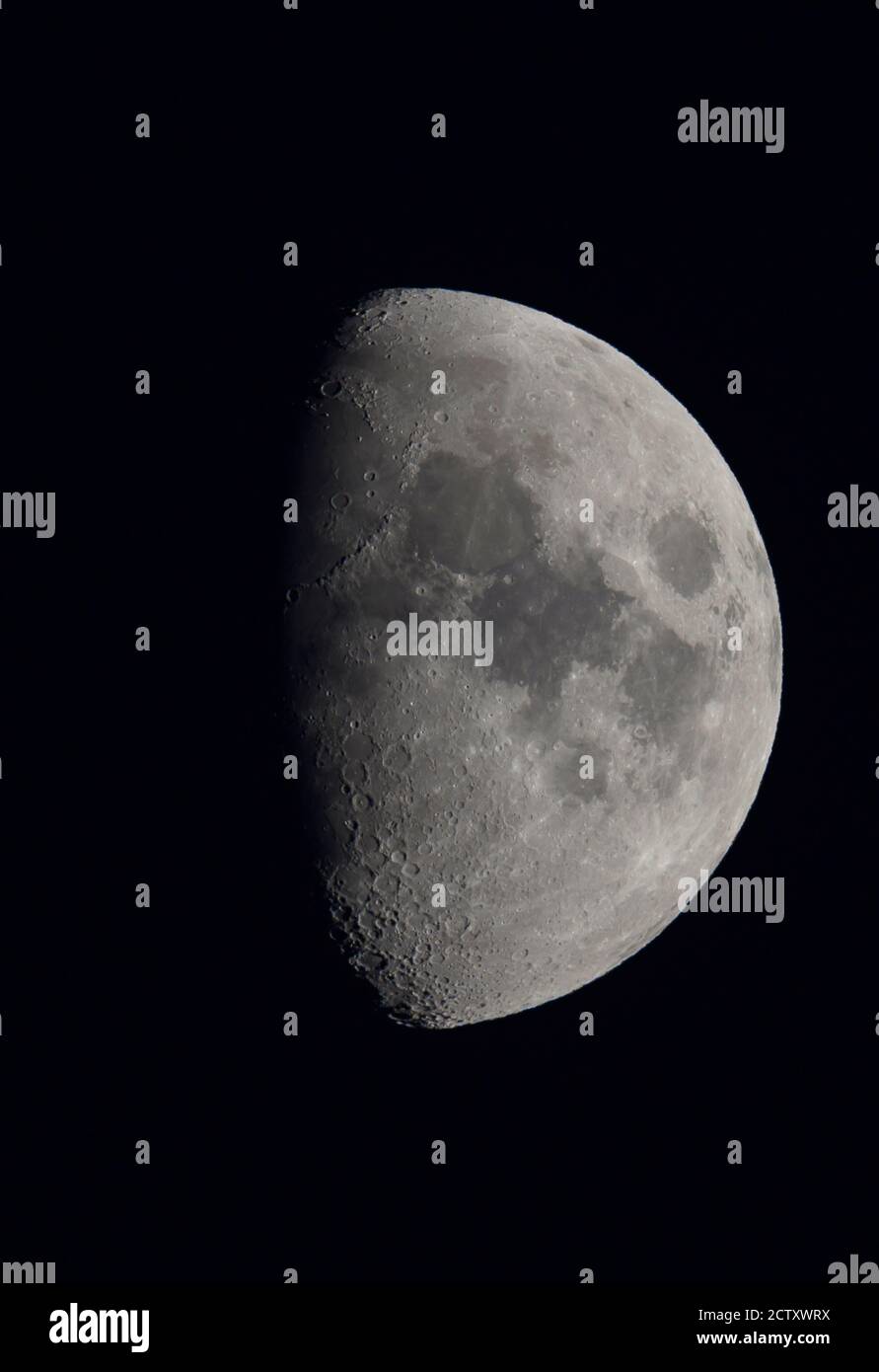 Sinus amoris hi-res stock photography and images - Alamy