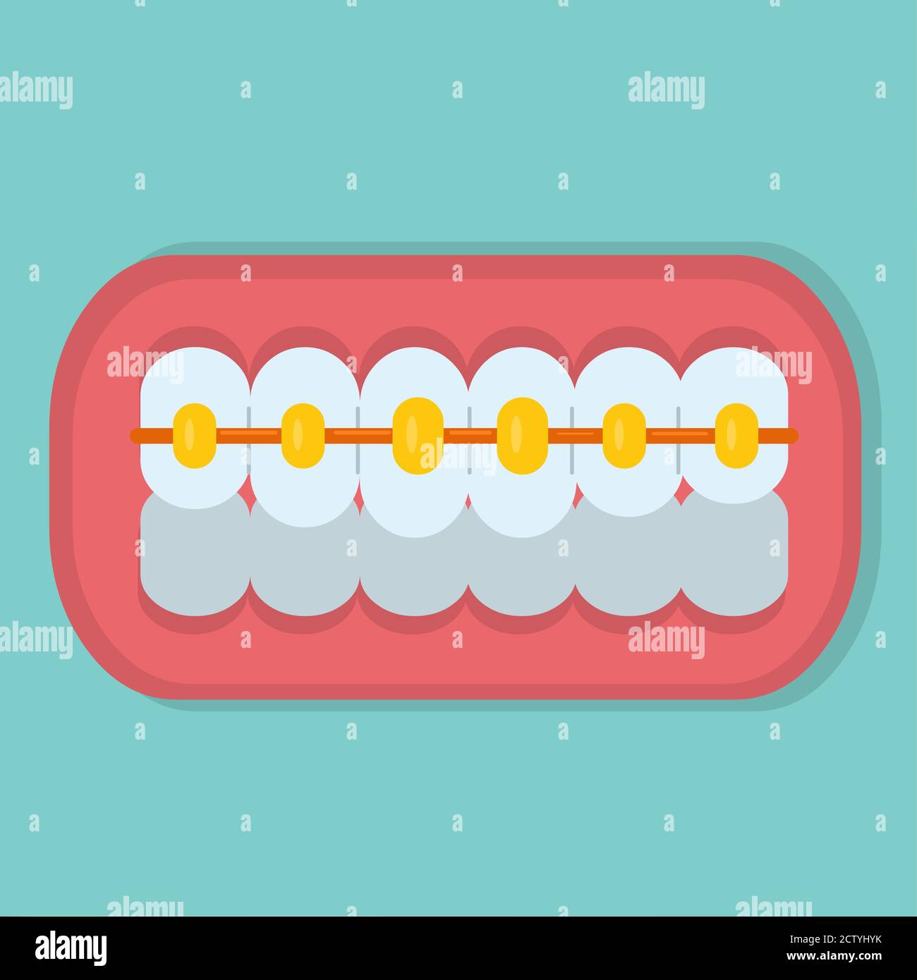 Teeth braces orthodontist treatment Stock Vector Images - Alamy