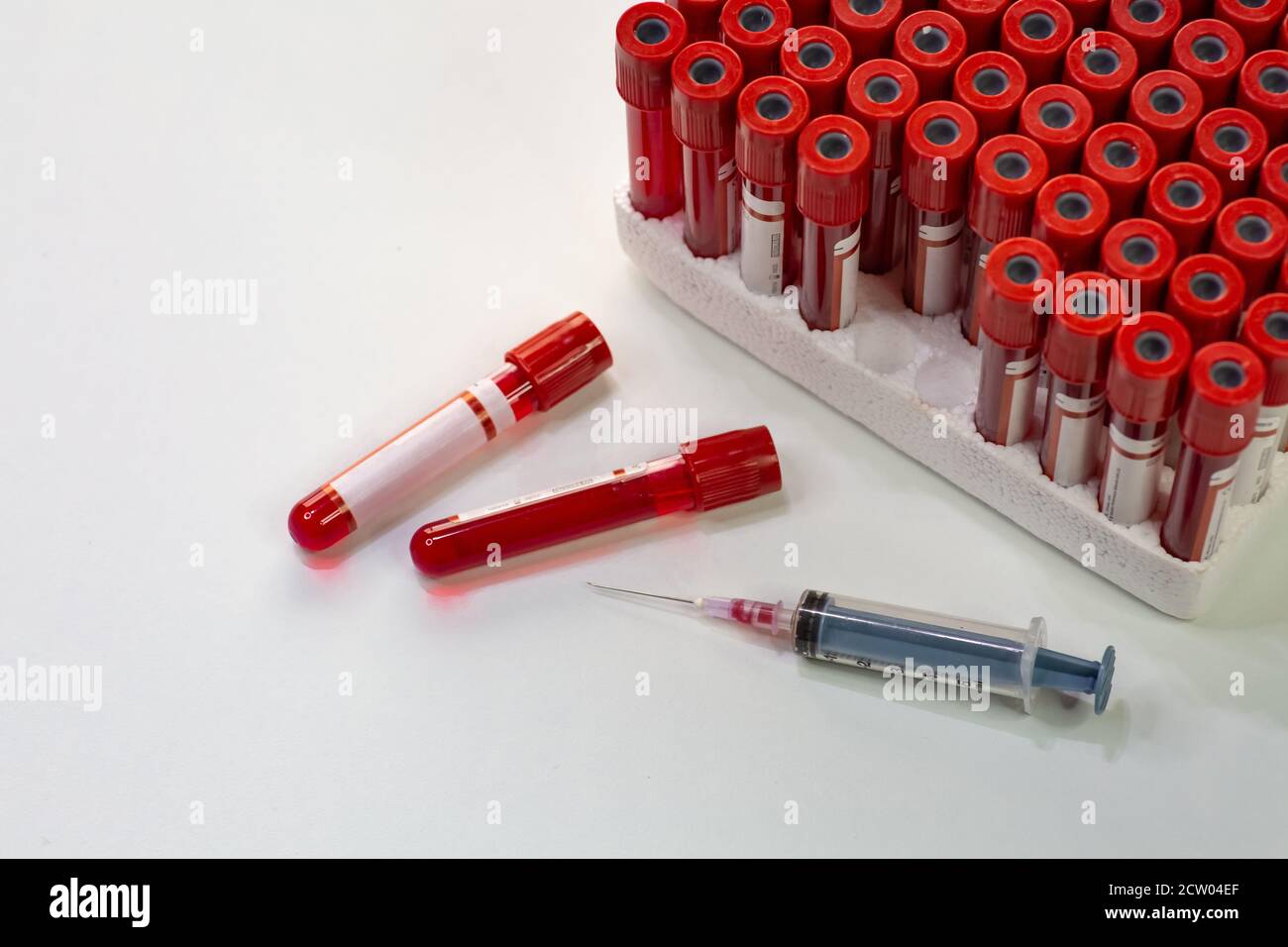 Injection syringe with vials of blood samples of patients at a medical ...