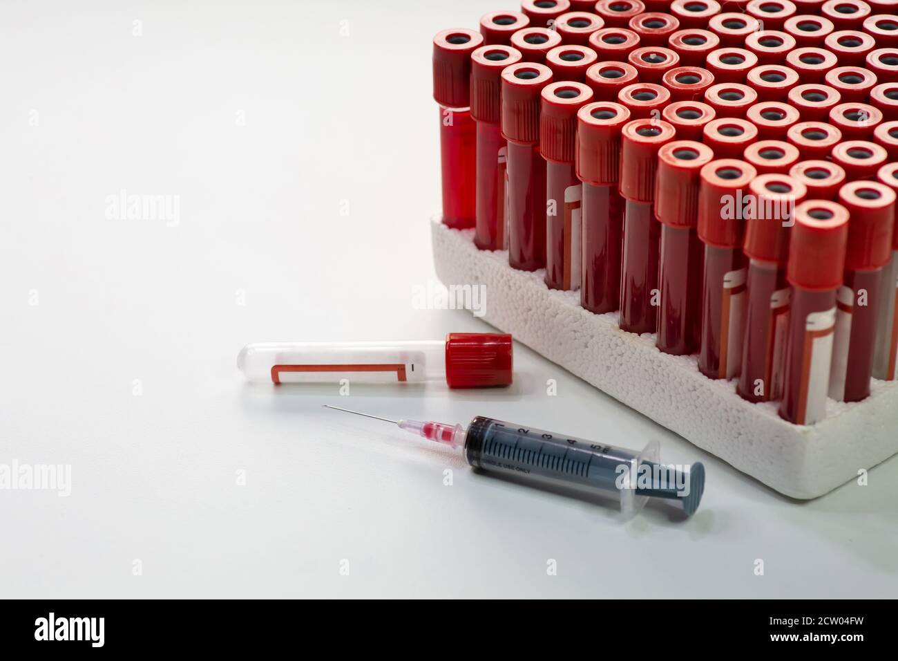 Injection syringe with vials of blood samples of patients at a medical ...