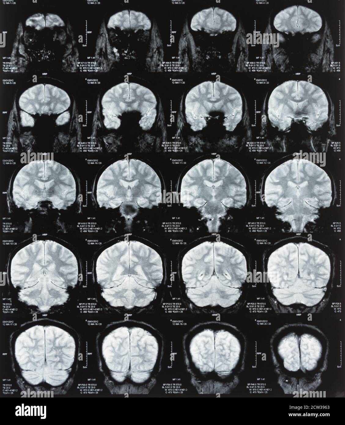 Magnetic resonance imaging, ct scan with brain Stock Photo - Alamy