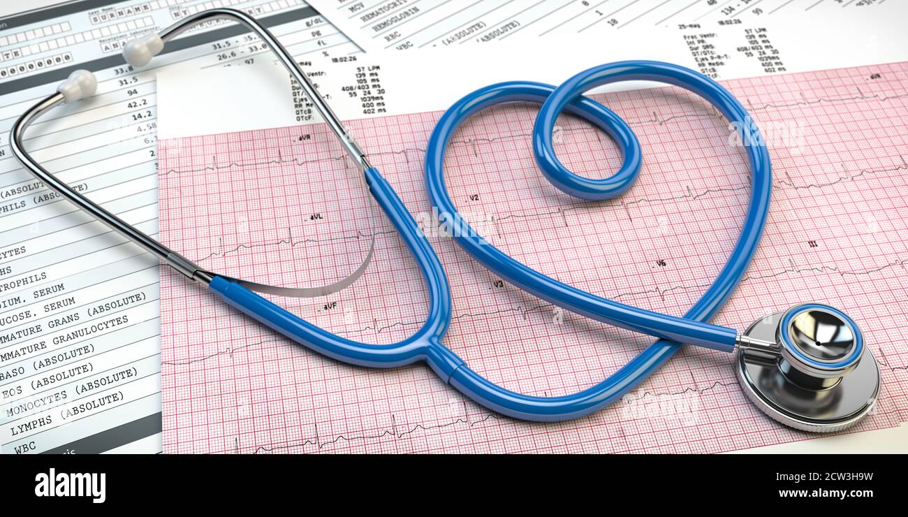 Stethoscope in form of heart on beat cardiogram report. Medical ...