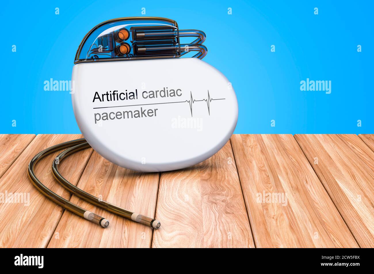 Pacemaker electrodes hi-res stock photography and images - Alamy