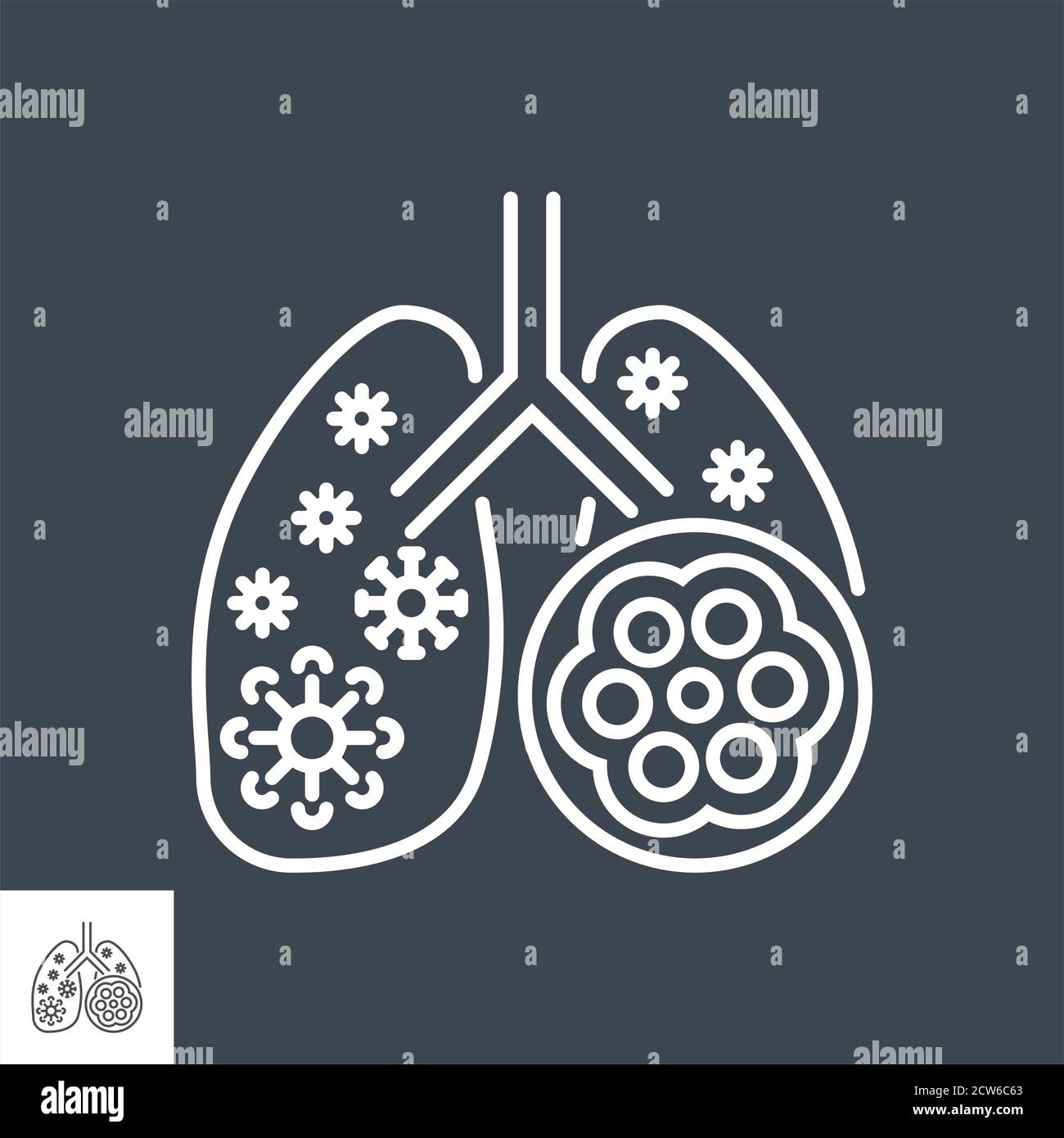 Pneumonia lung cancer disease Stock Vector Images - Alamy