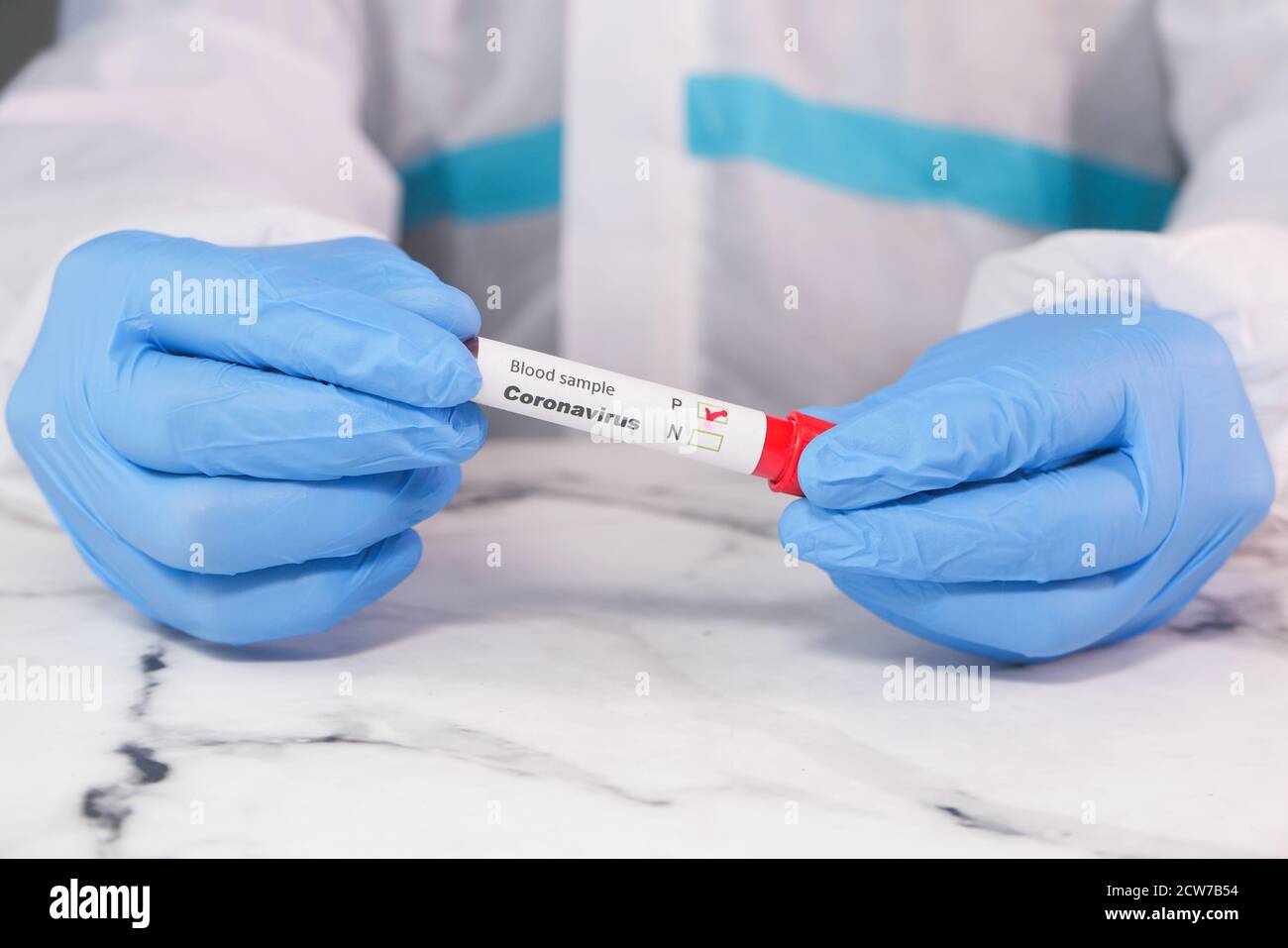 laboratory technician hand holding blood test tube Stock Photo - Alamy