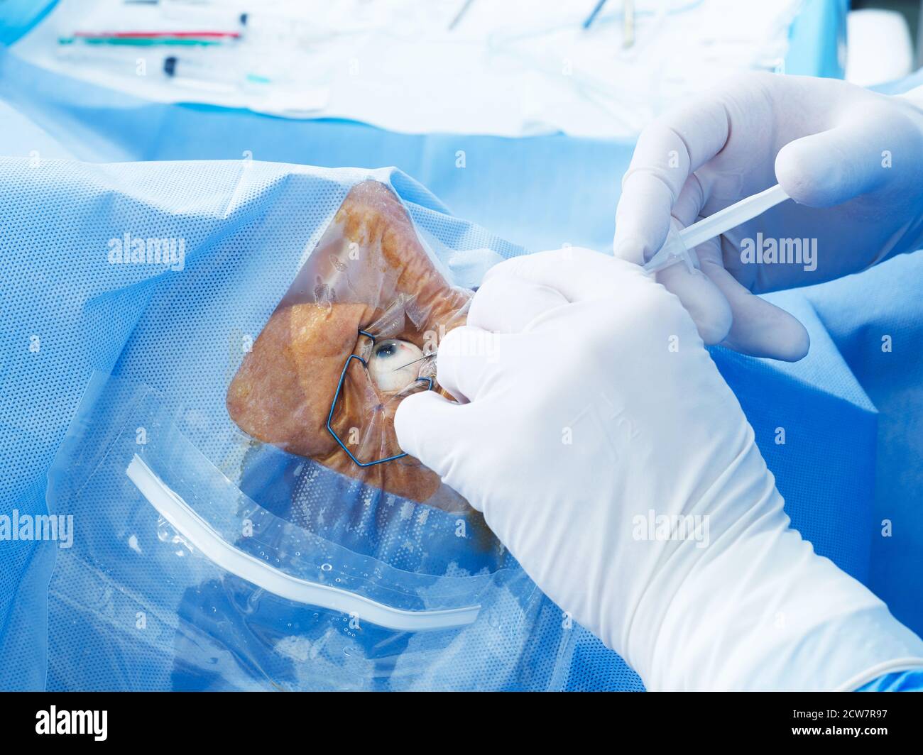 Woman with eye open in hospital and surgeon with gloves and syringe ...