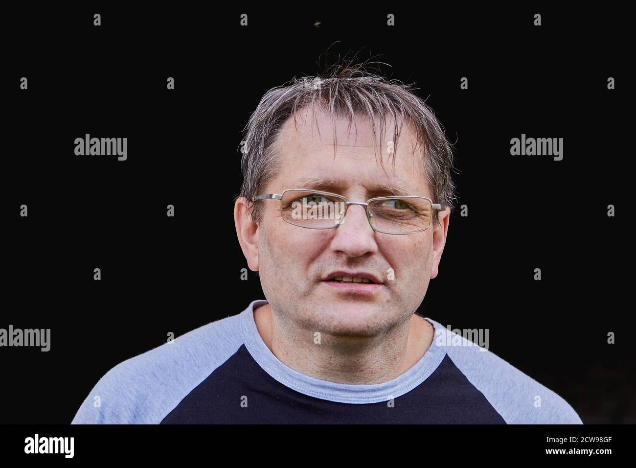 portrait of an adult male face, strabismus or exotropia Stock Photo - Alamy
