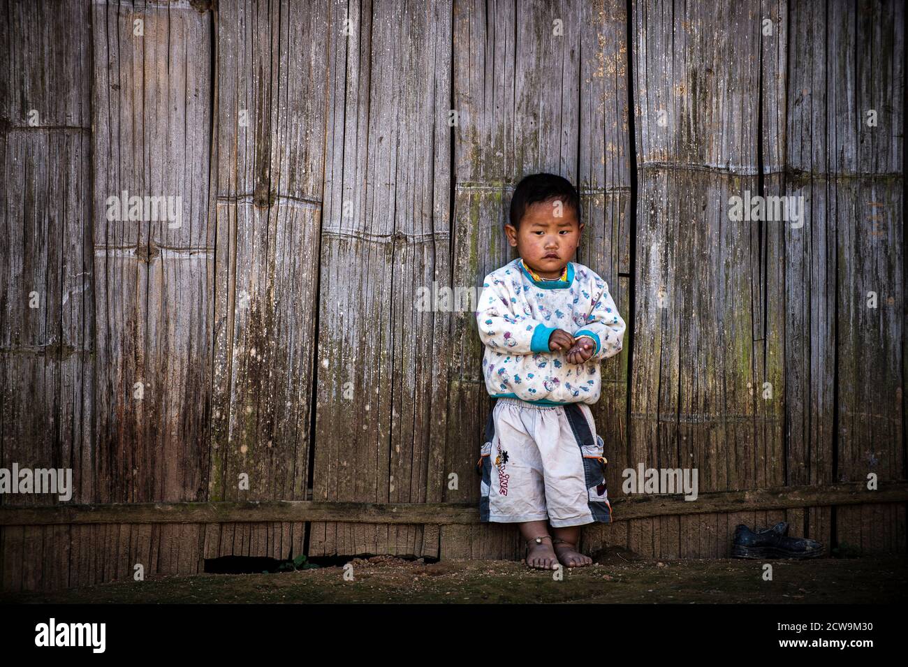 Chiang Mai / Thailand - Jan 16 2016 : Rough skin boy Ragged torso, worn ...