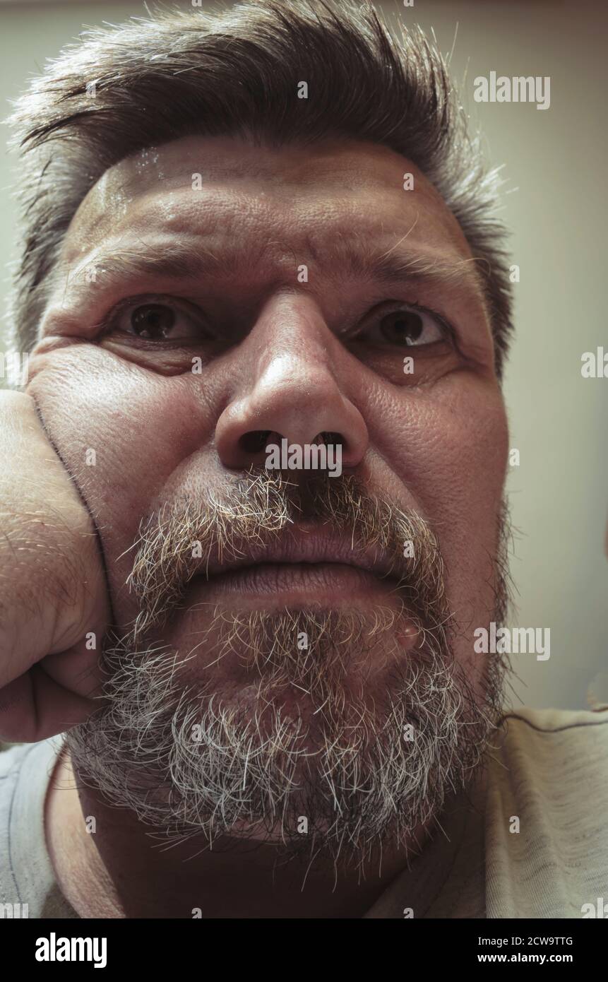 Mole in the forehead hi-res stock photography and images - Alamy