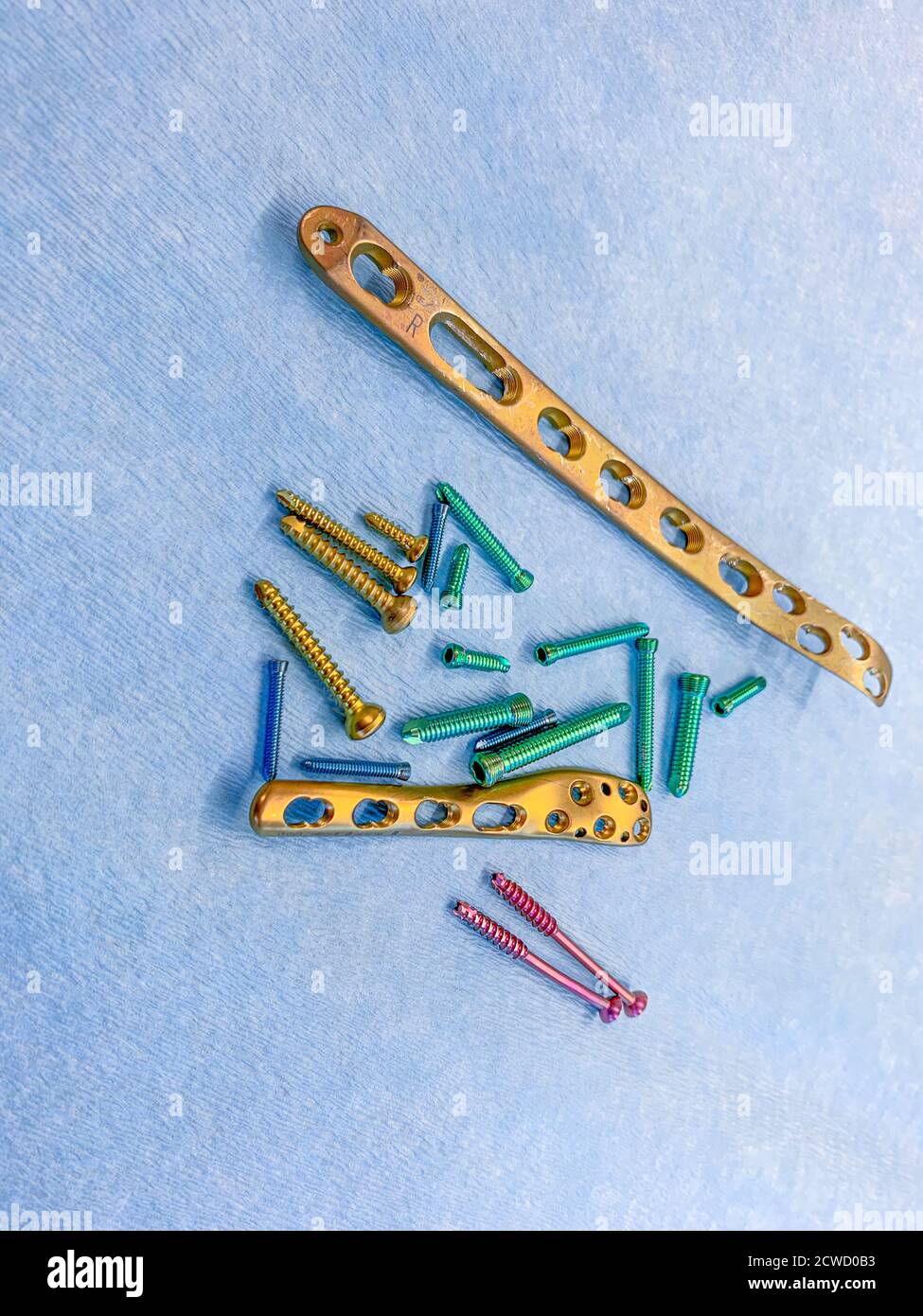 Titanium Plate In Leg