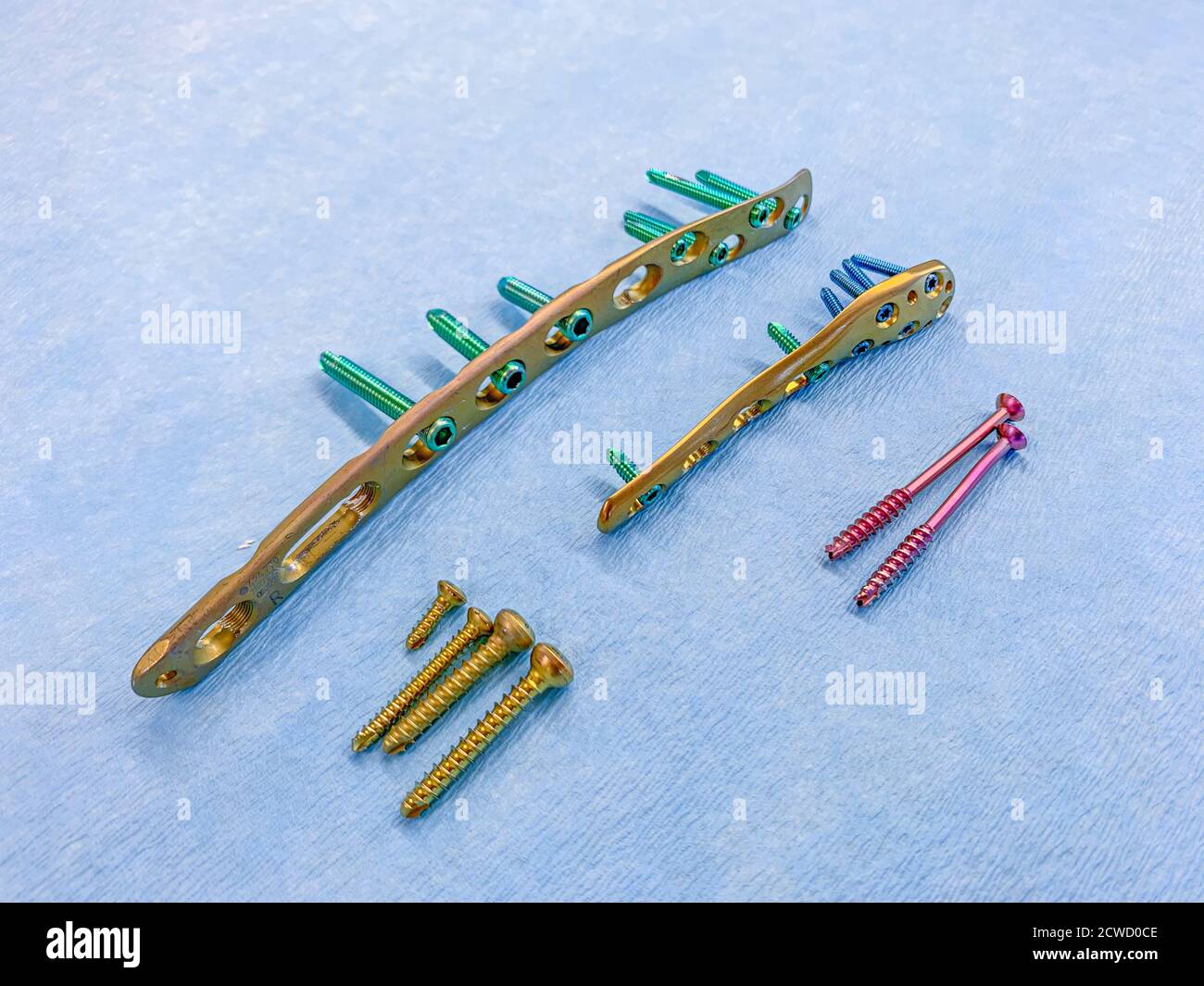 Hospital x ray plates hi-res stock photography and images - Alamy