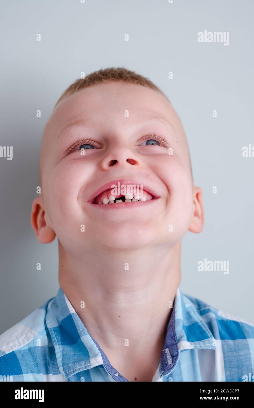 Baby smile without upper baby tooth. A hole in a child's smile ...