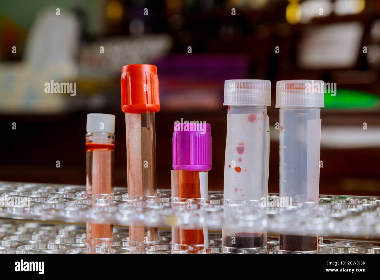 Medical equipment blood sample tube from a rack with analysis in the ...