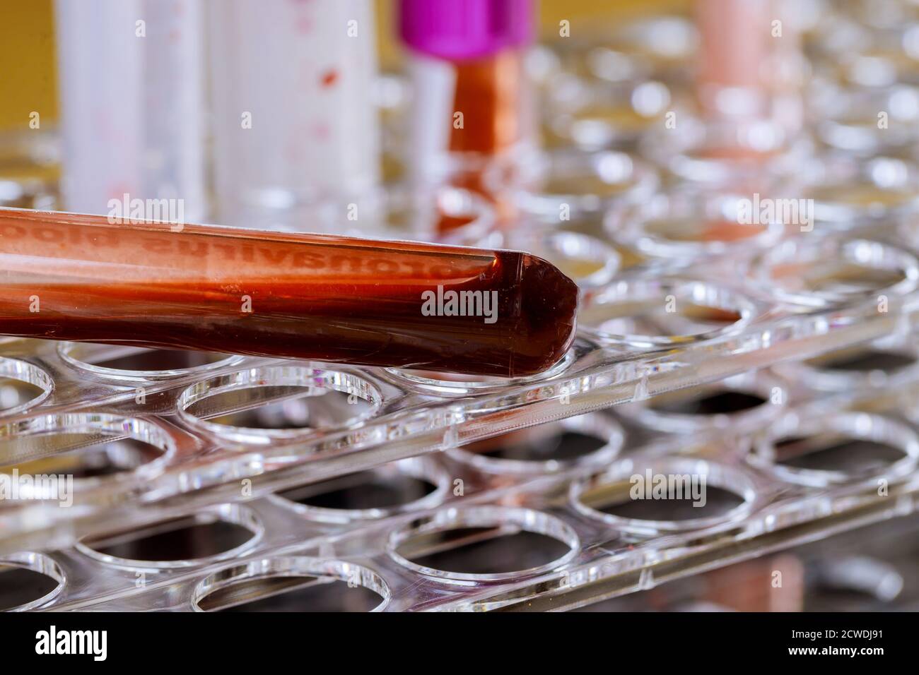 Tubes of blood prepare for health check in laboratory at the clinic ...