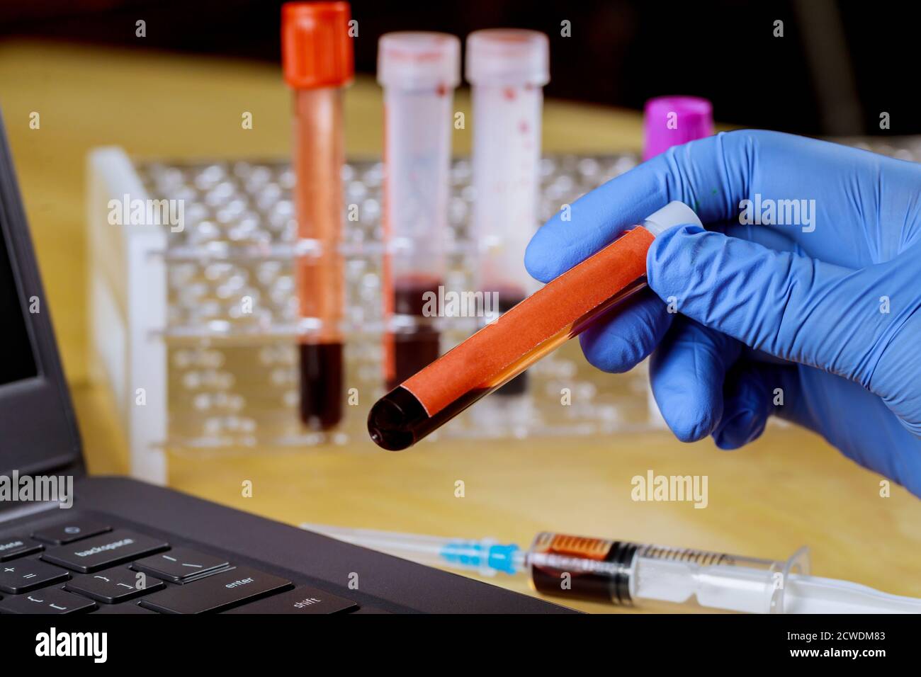 Medical equipment blood test working with chemistry in a laboratory ...