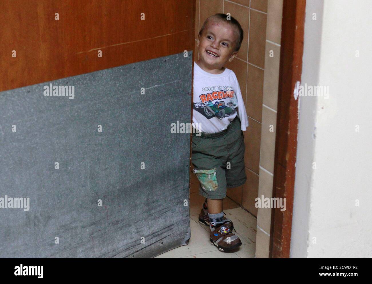 Born without arms hi-res stock photography and images - Alamy