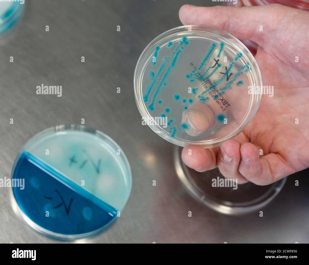 E Coli Petri High Resolution Stock Photography and Images - Alamy