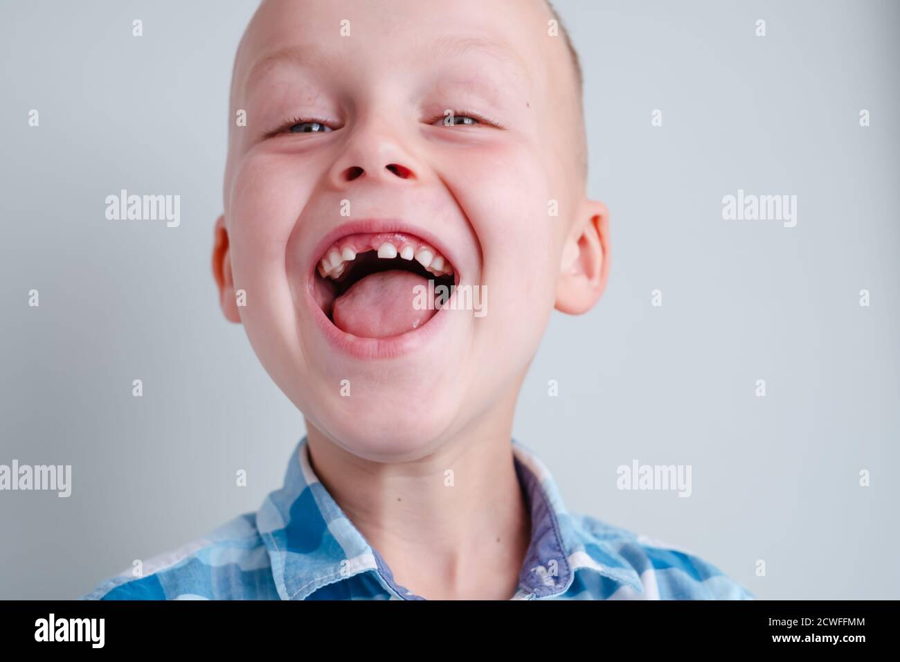Baby smile without upper baby tooth. A hole in a child's smile ...
