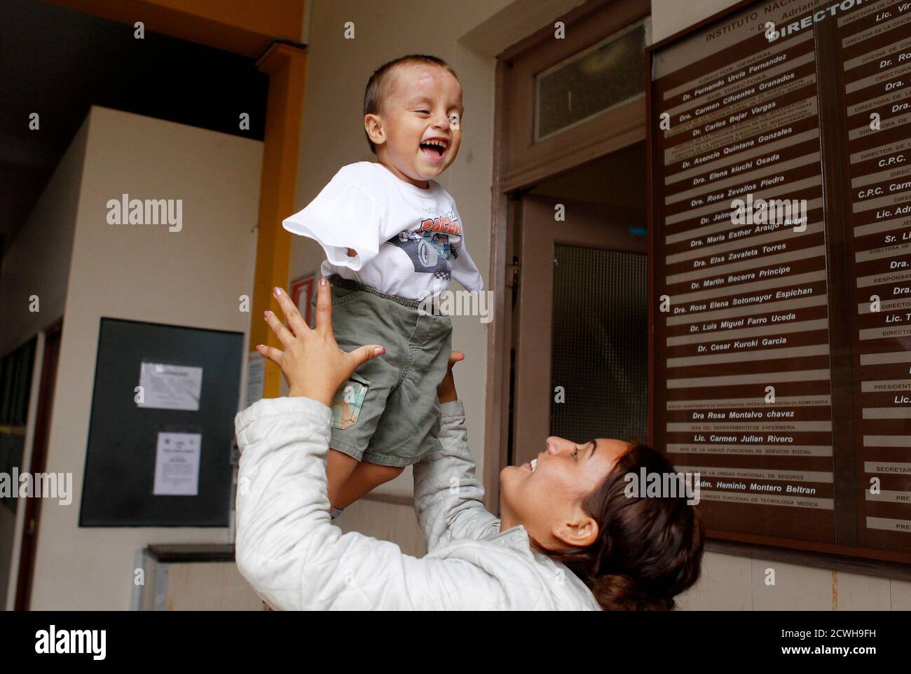 Born without arms hi-res stock photography and images - Alamy