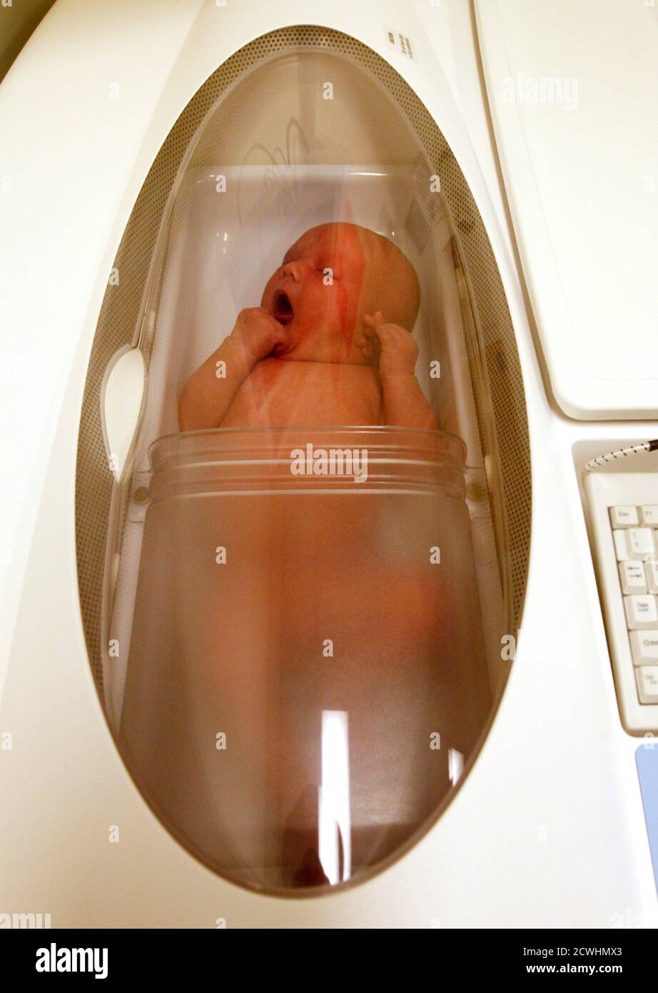 Human body mass hi-res stock photography and images - Alamy