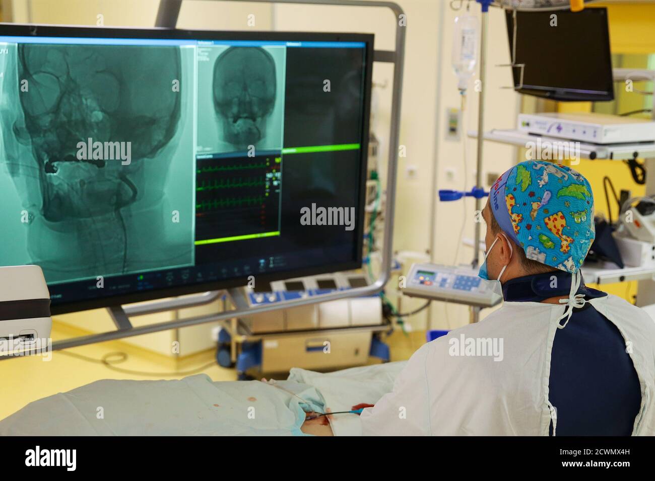 X Ray Of Blood Vessels High Resolution Stock Photography and Images - Alamy