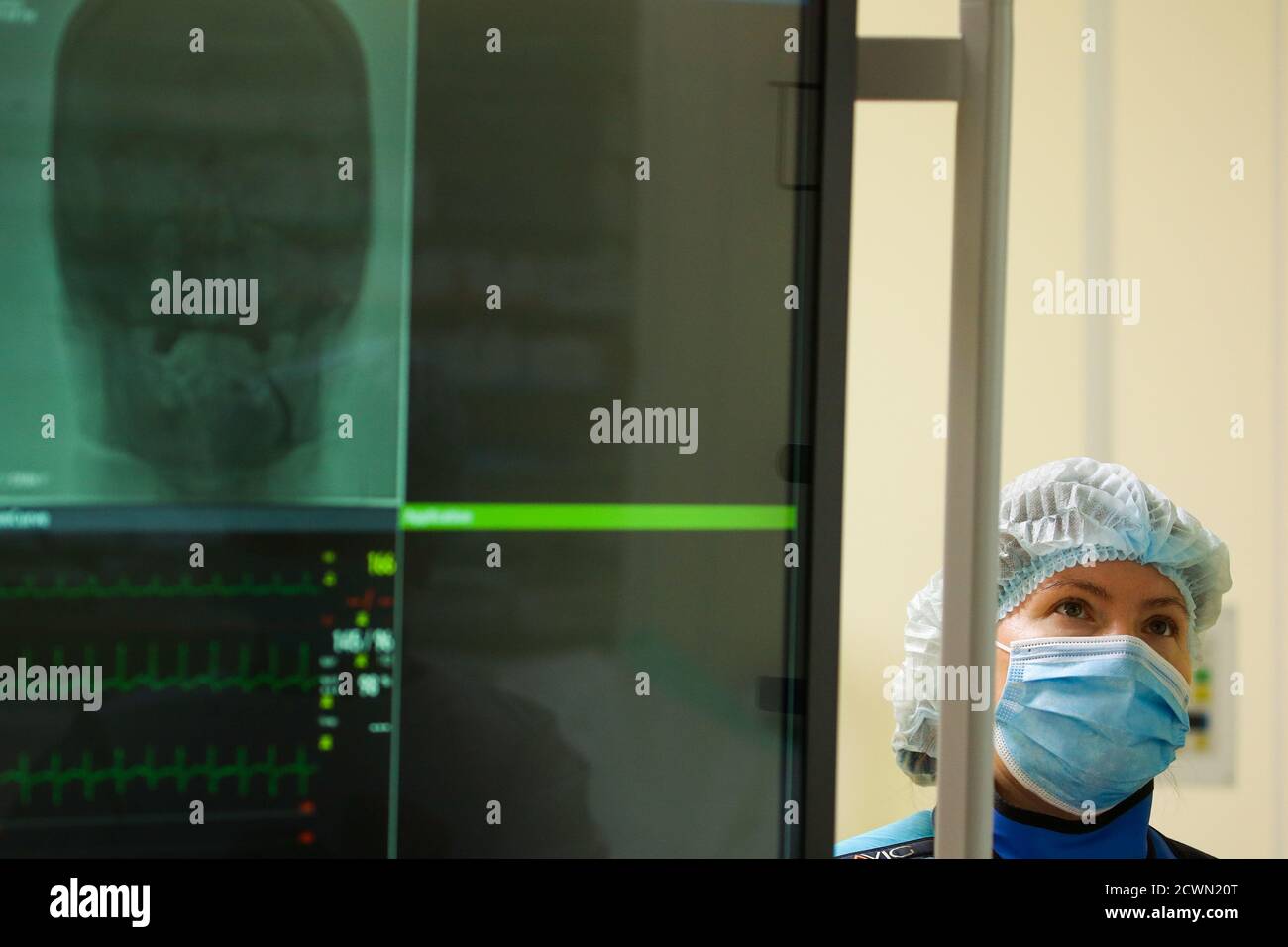 Congenital Abnormalities High Resolution Stock Photography and Images ...