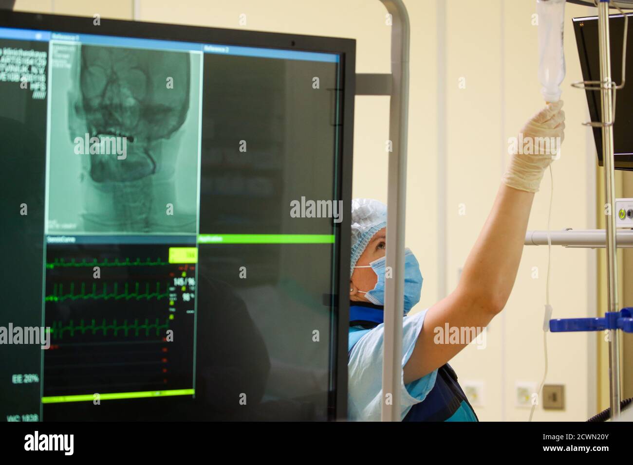 Congenital Abnormalities High Resolution Stock Photography and Images ...