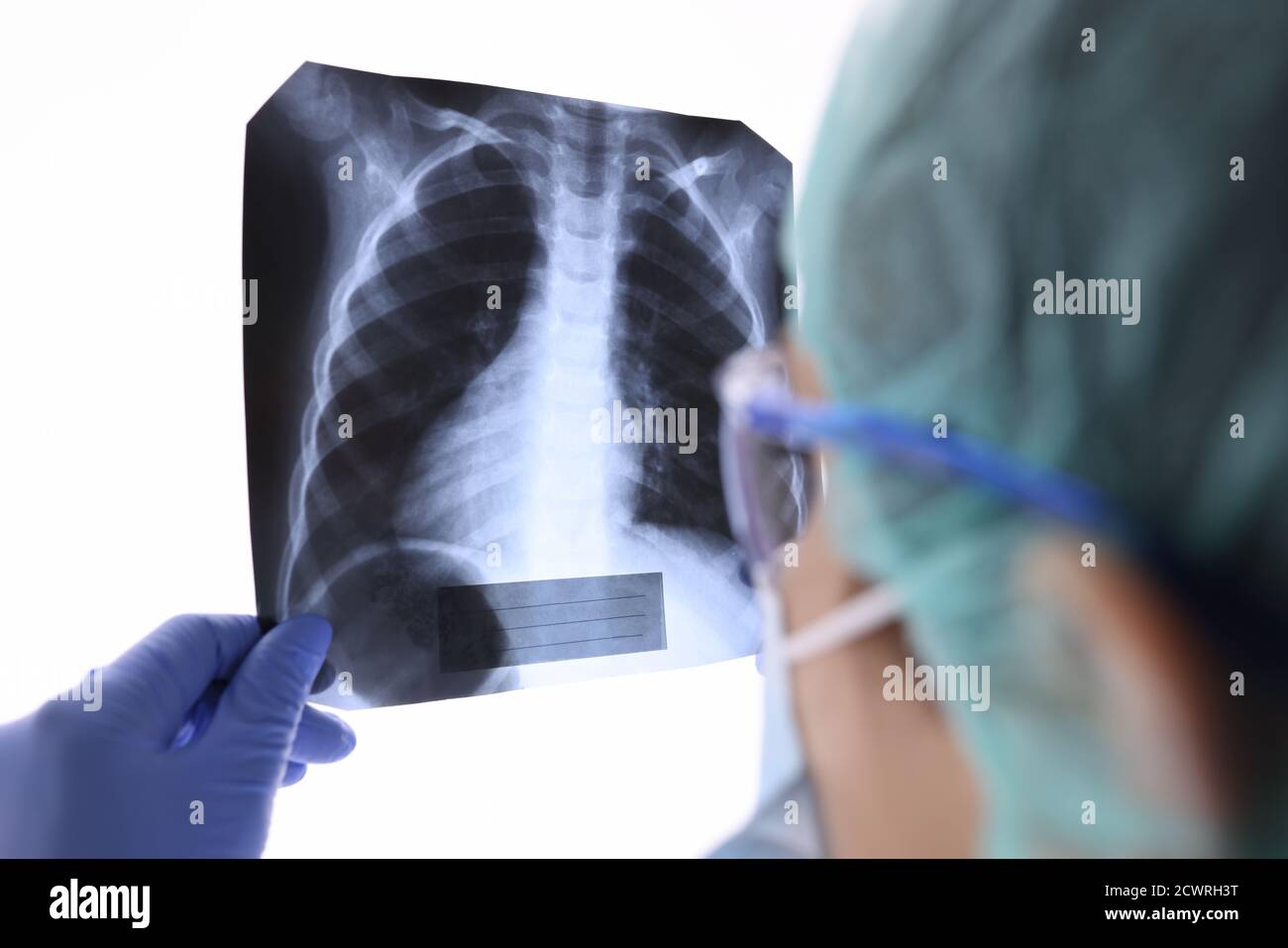 Ct scan heart and lungs hi-res stock photography and images - Alamy