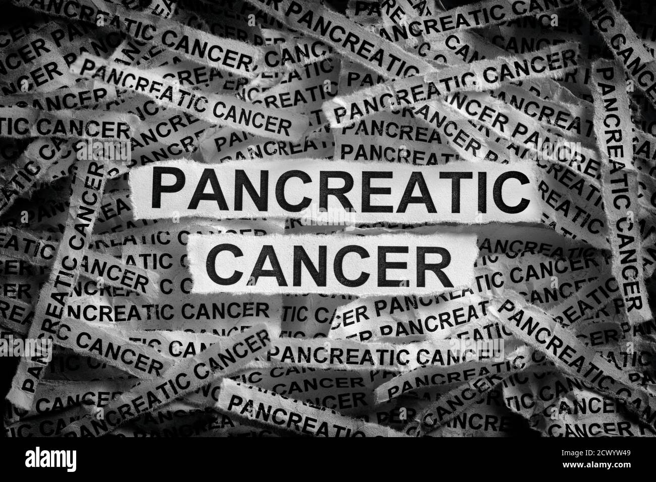 Pancreatic cancer hi-res stock photography and images - Alamy
