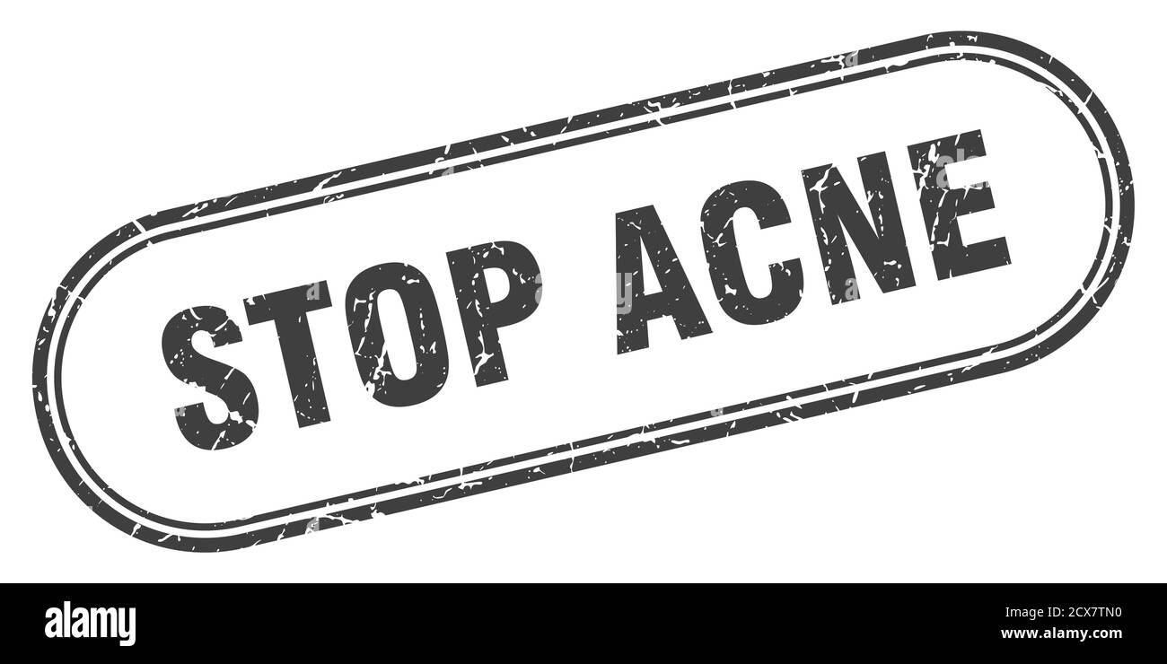 stop acne stamp. rounded grunge sign on white background Stock Vector ...
