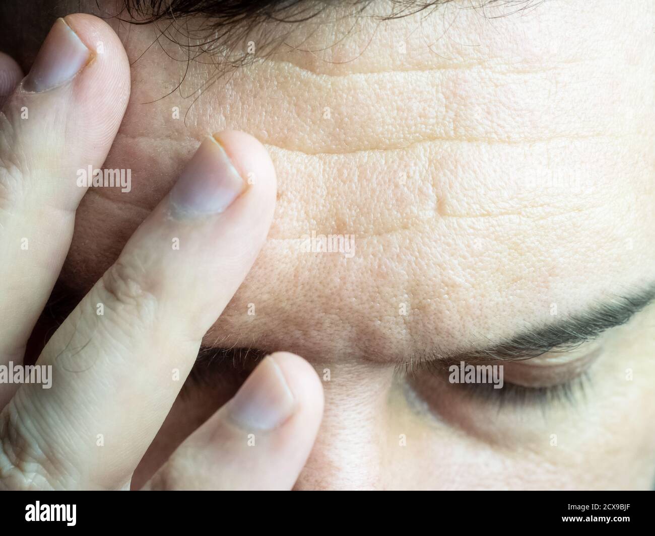 A close-up photo of man pressing his fingers to his forehead, wrinkling ...