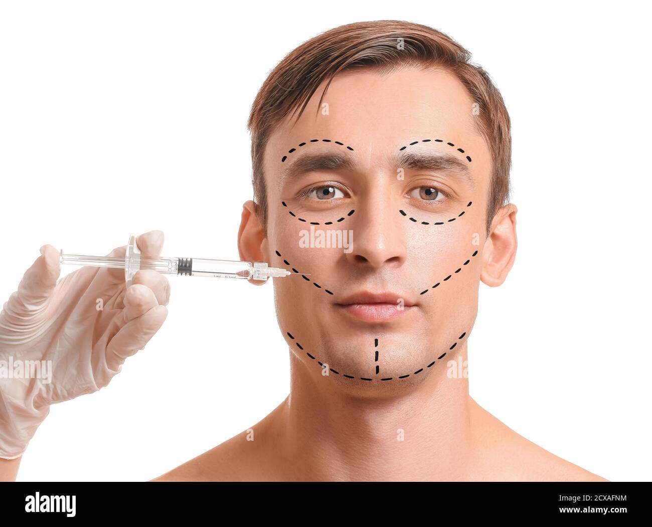 Handsome man receiving filler injection on white background Stock Photo ...