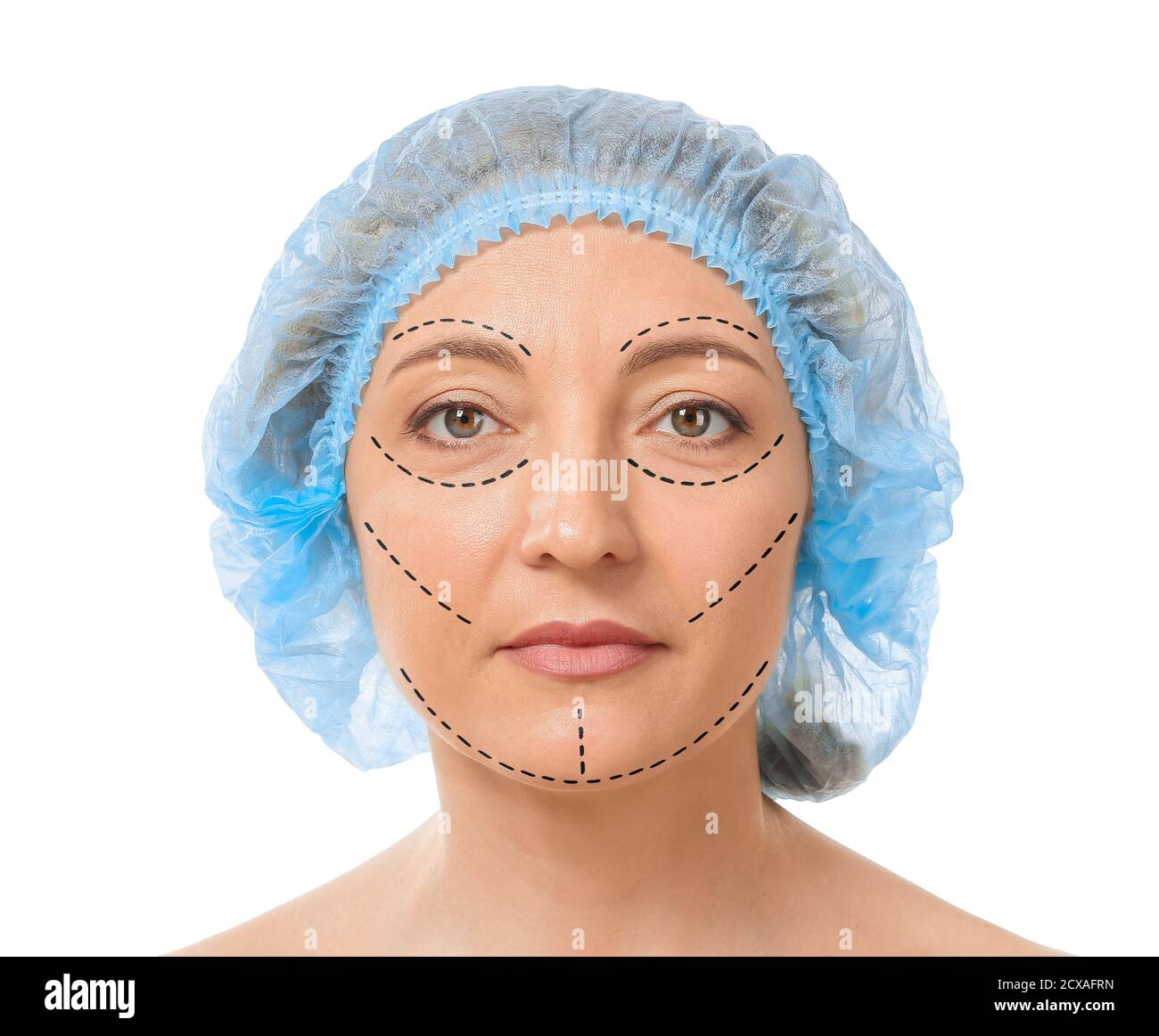 Mature woman with marks on her face against white background. Plastic ...