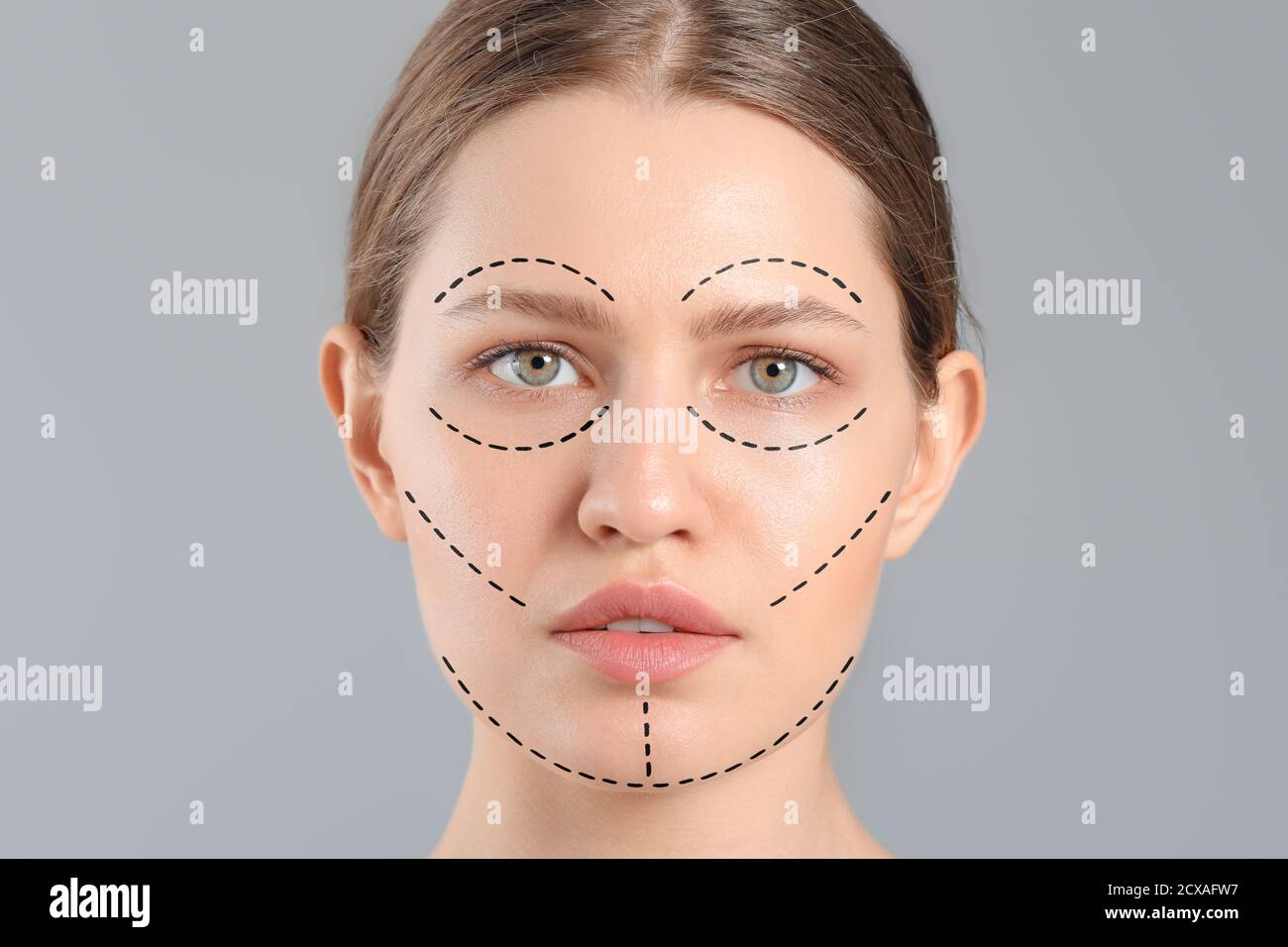 Young woman with marks on her face against grey background. Plastic ...