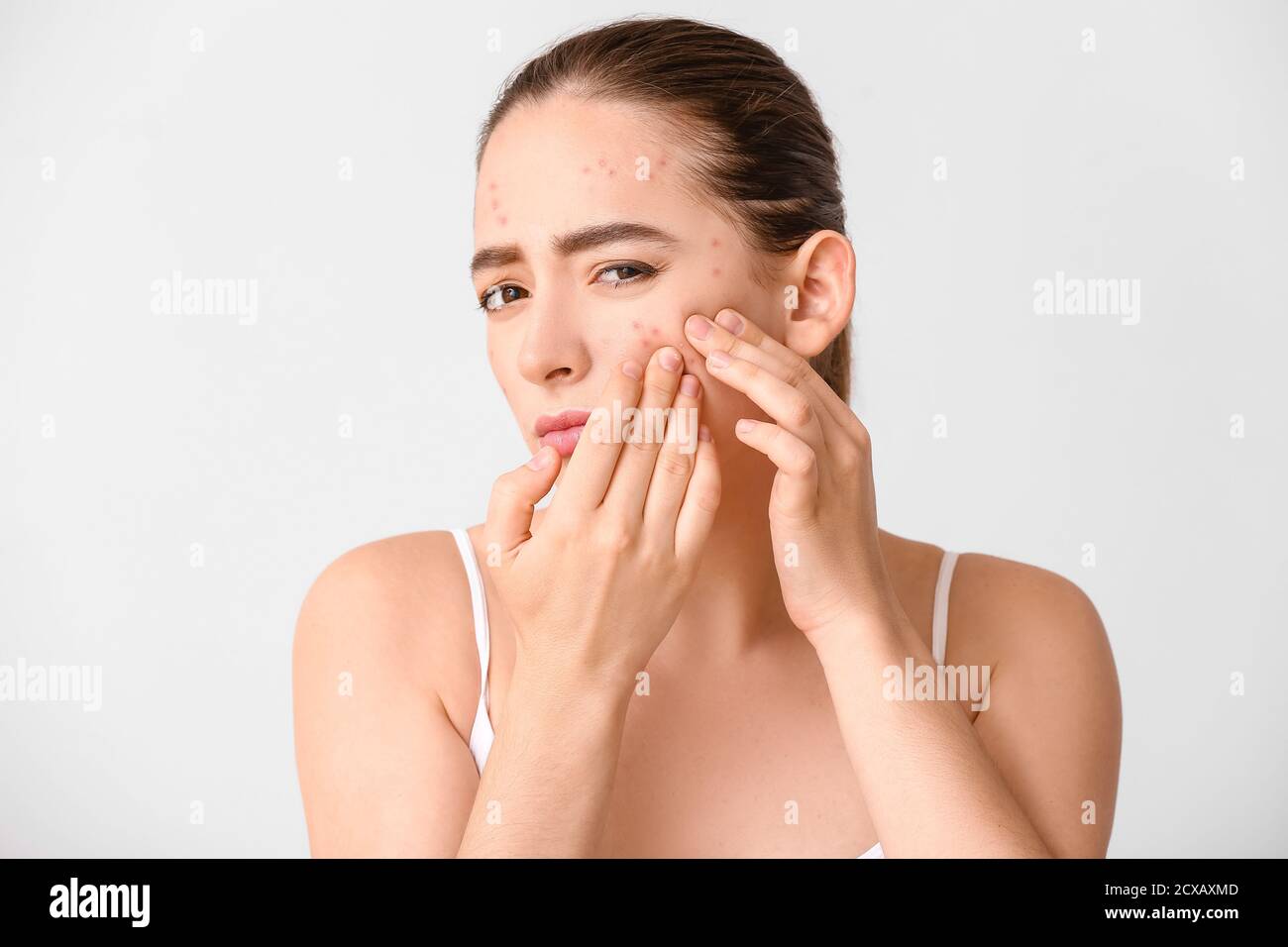 Young woman with acne problem squishing pimples on white background ...