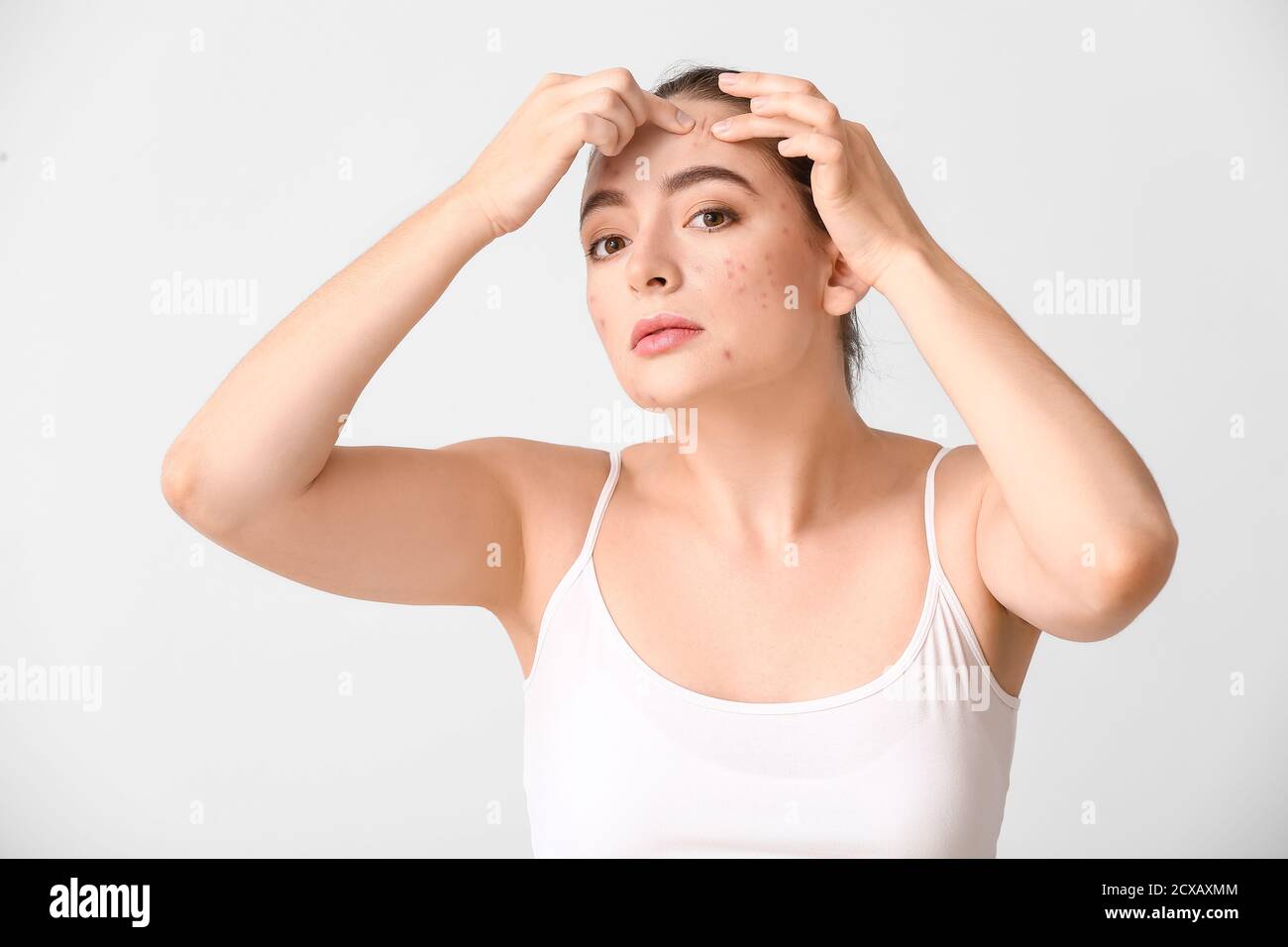 Young woman with acne problem squishing pimples on white background ...