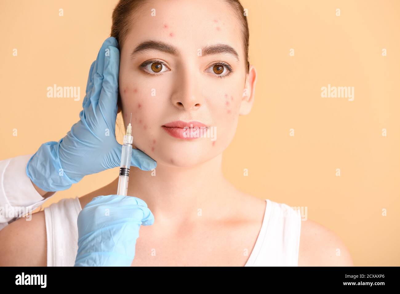 Young woman with acne problem receiving injection in her face against ...