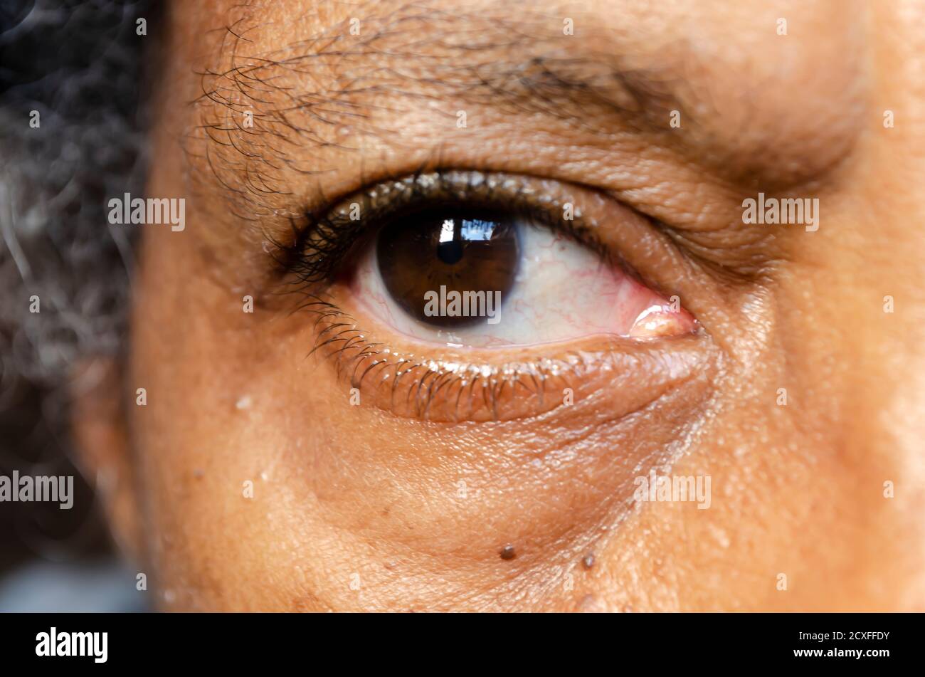 Human right Eye Stock Photo - Alamy