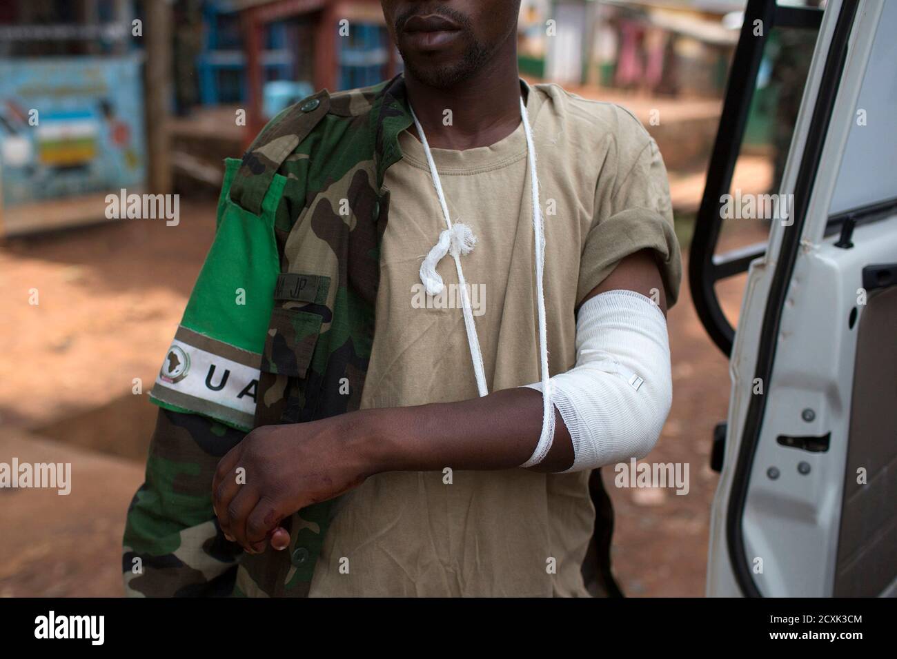 Shrapnel Wound High Resolution Stock Photography and Images - Alamy