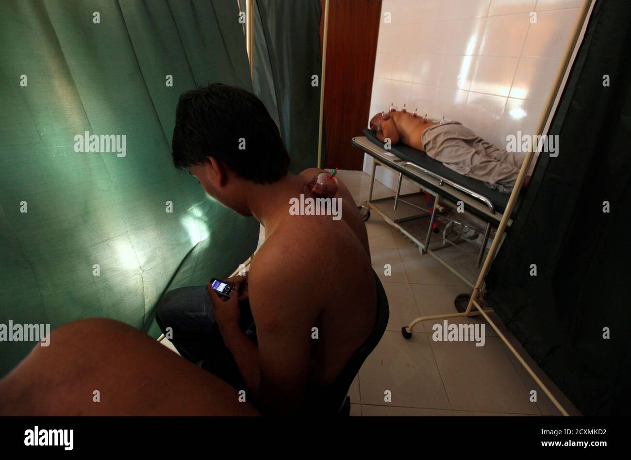 Hijama treatment hi-res stock photography and images - Alamy