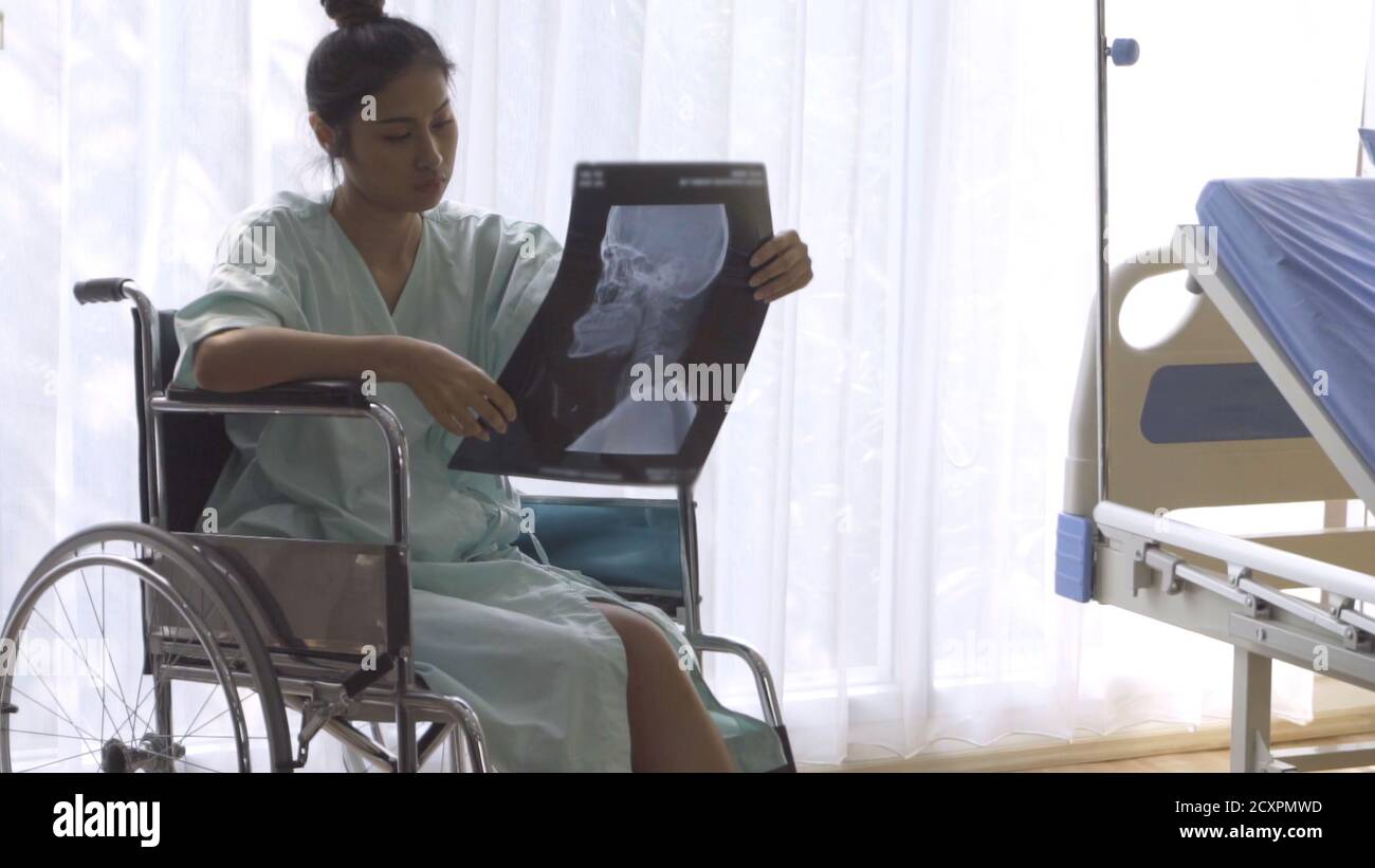 Serious patient looking at x-ray image of her brain injury surgery. Bad ...