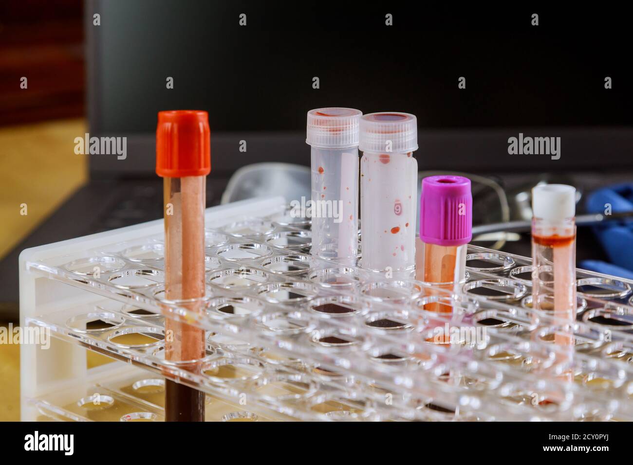 A blood sample with in laboratory to check the sampling tube placed on ...