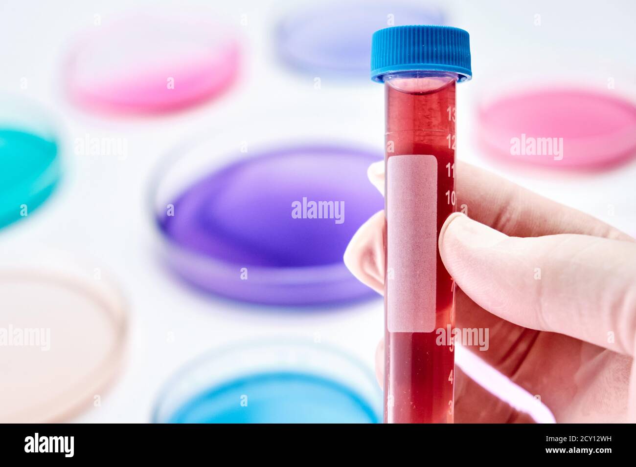 Blood sample in a plastic test tube on the background of Petri dish ...