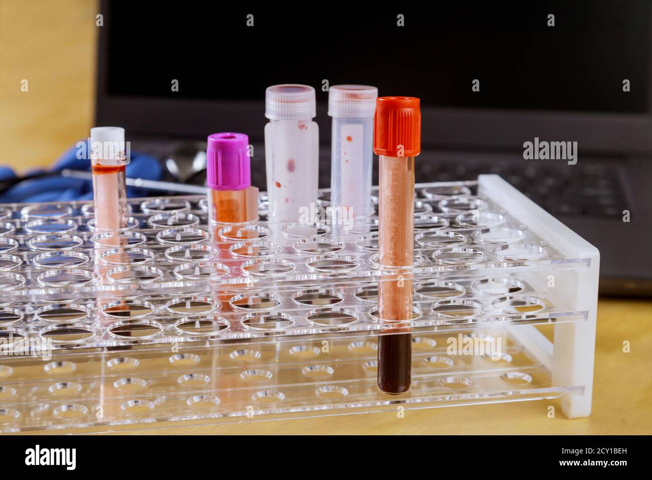 Blood Sample Racks at Emily Jenkins blog