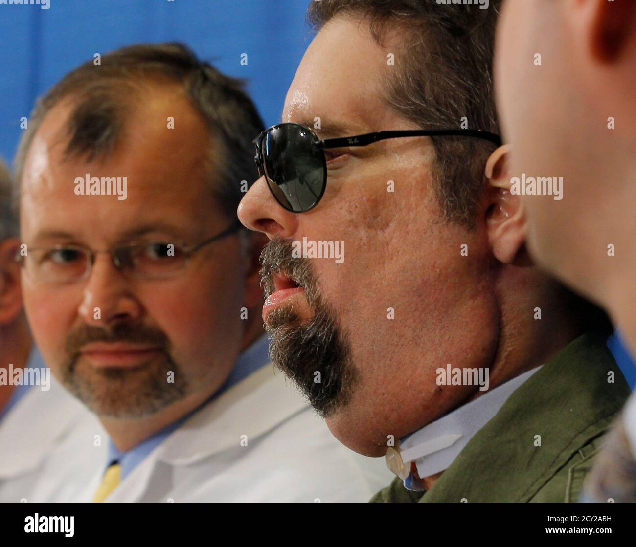 Face transplant hi-res stock photography and images - Alamy