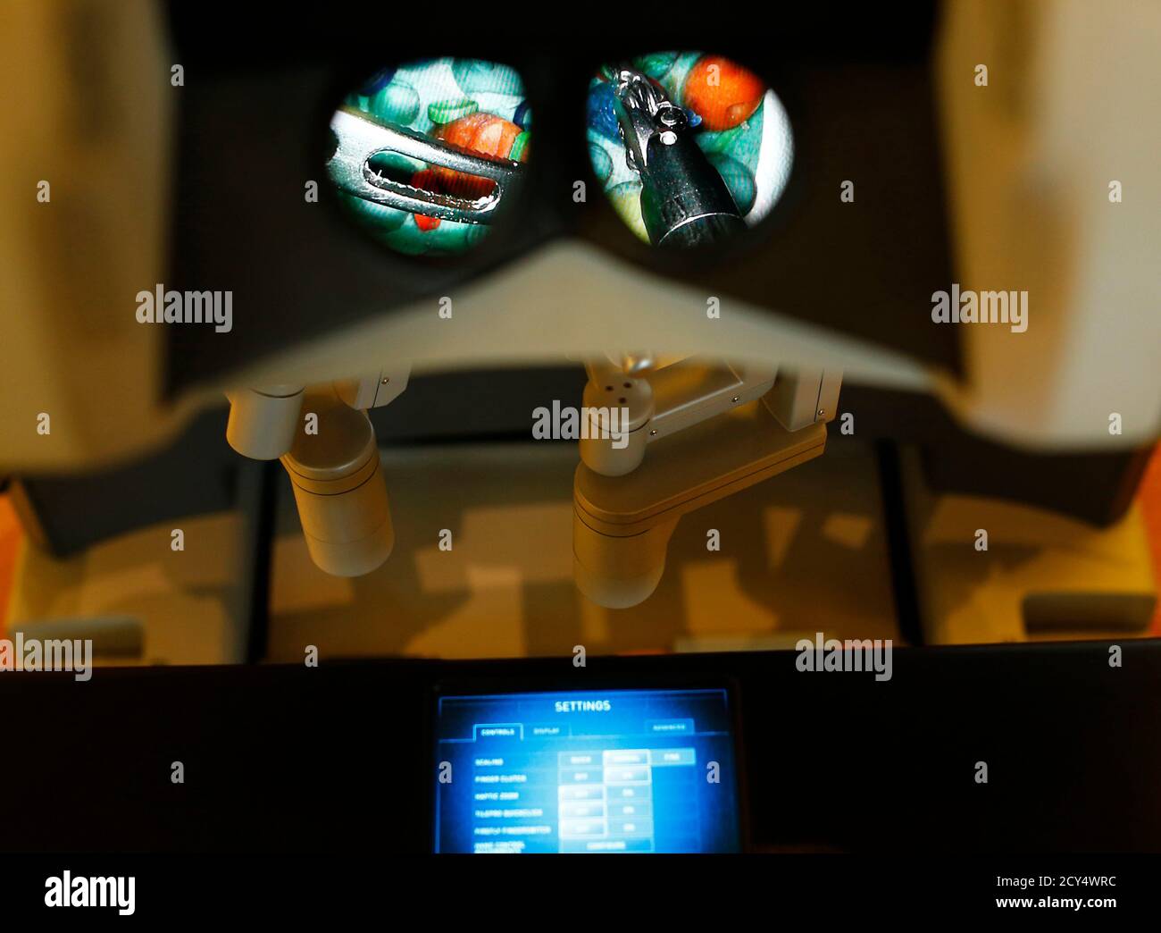 Da vinci xi robot surgical system hi-res stock photography and images ...