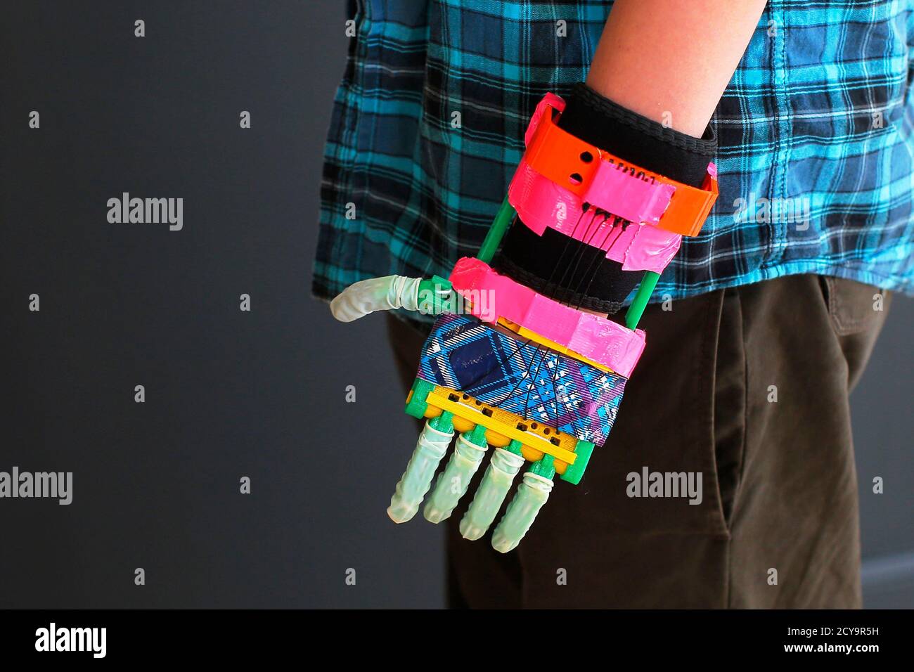 3d printed hand prosthetic hi-res stock photography and images - Alamy