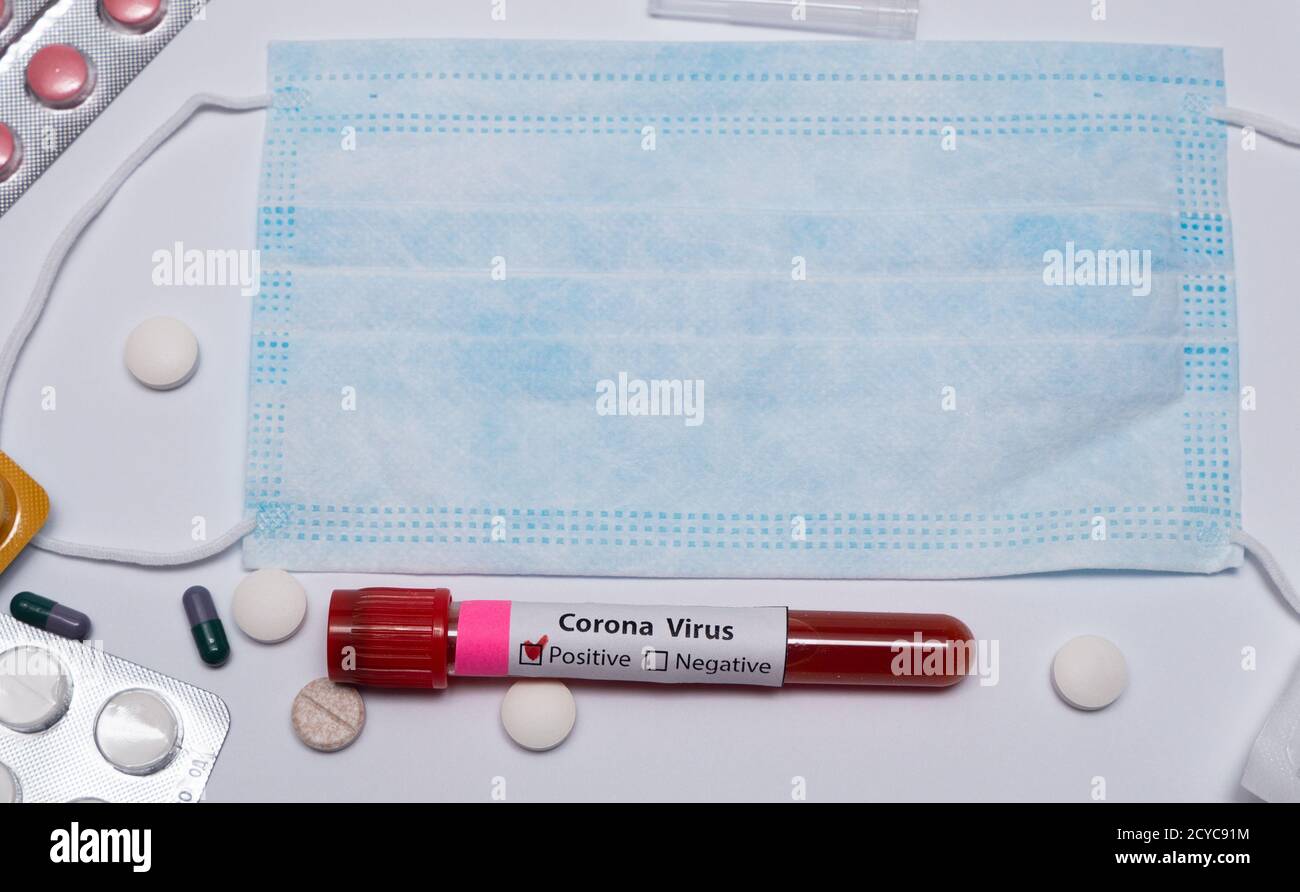 Blood positive test to coronavirus. Medical reseach, test-tube with ...