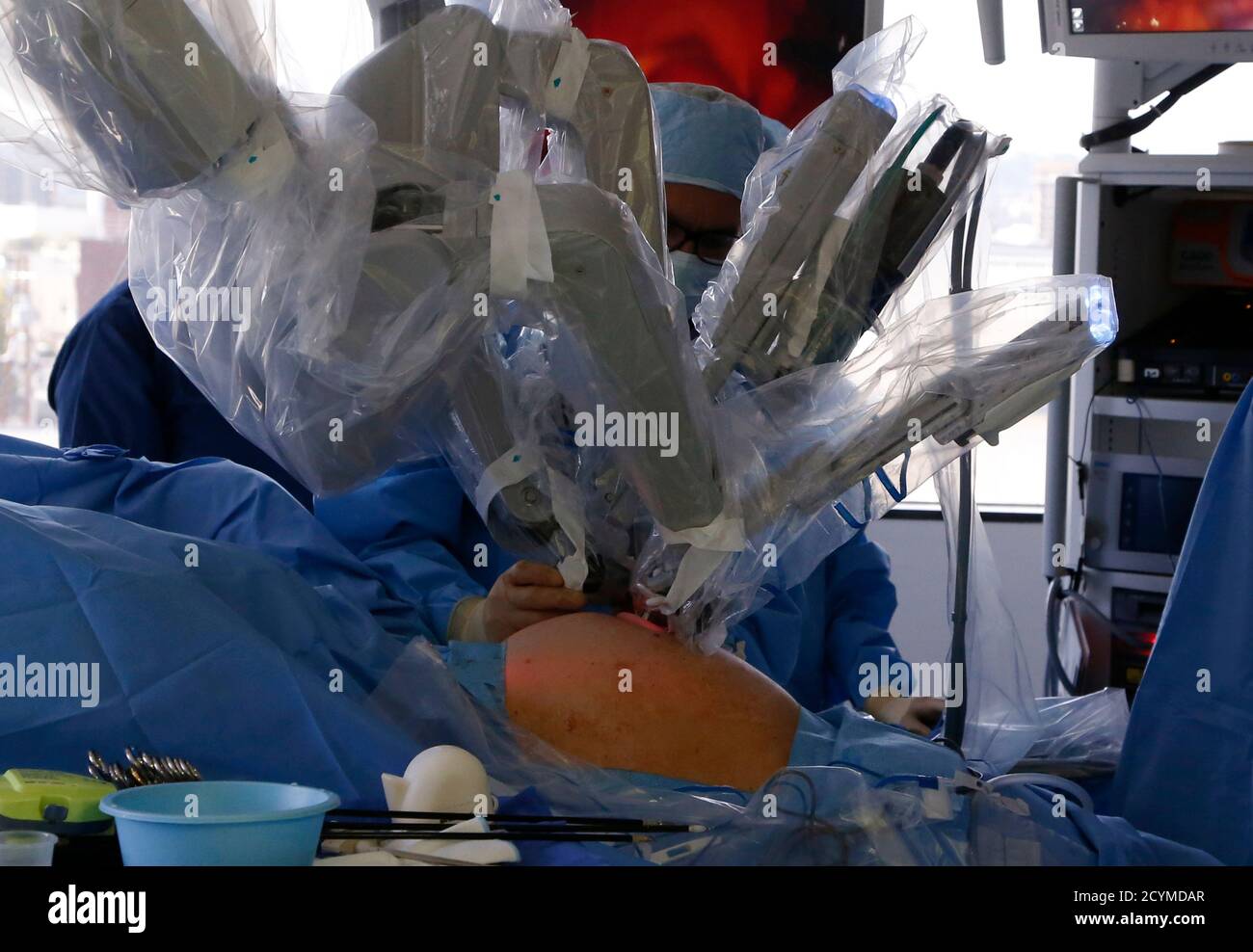 Fibroids High Resolution Stock Photography and Images - Alamy